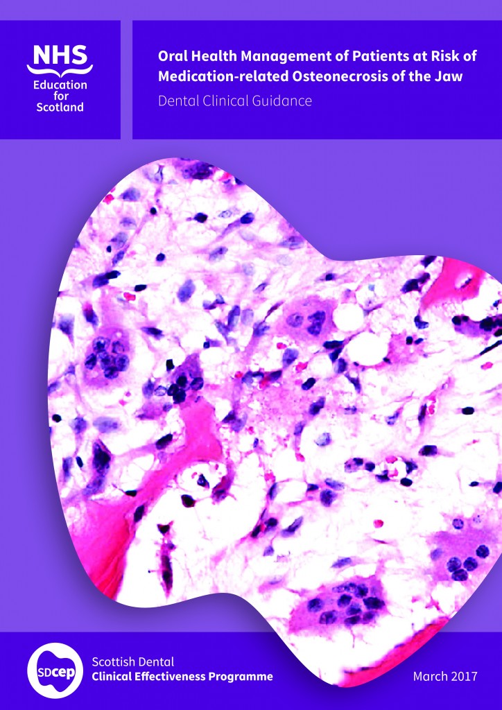 MRONJ – Scottish Dental